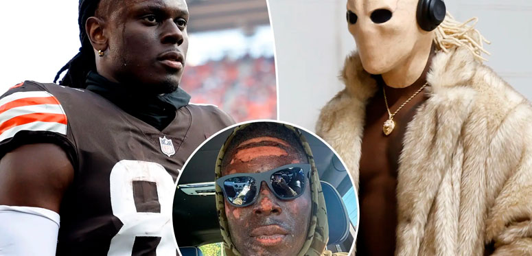 David Njoku reveals how the accident that burned his face happened: I ...